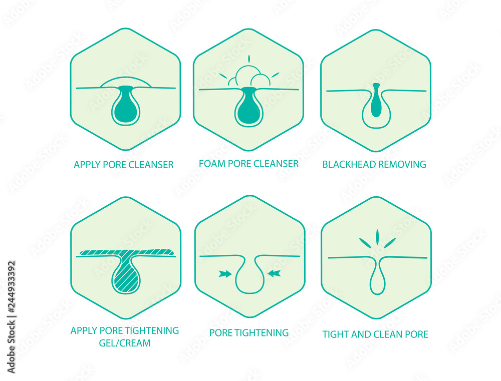 Blackheads removing and pore cleansing symbol set. Stock Vector | Adobe ...