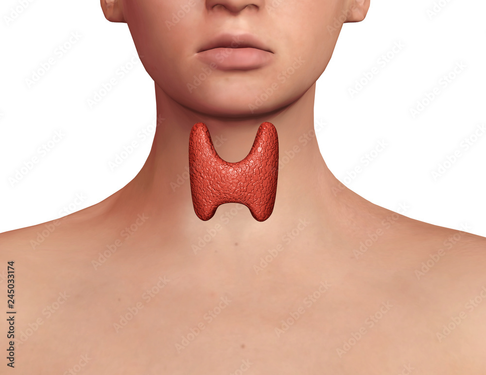 Thyroid gland exposed on the neck of a woman with endocrine disruption ...