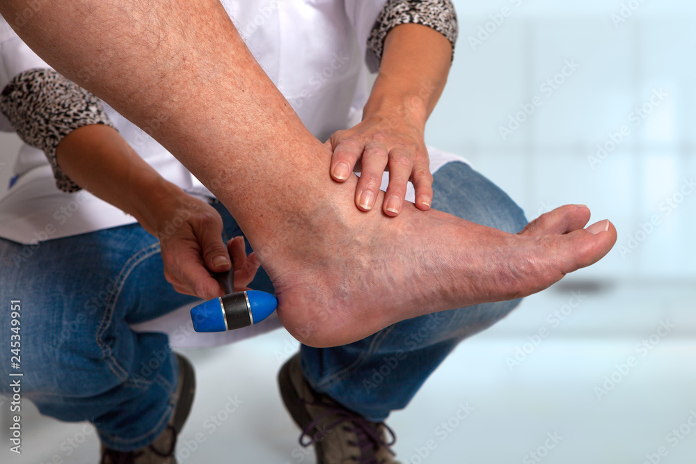 doctor examines the achilles tendon reflex of the patiënt with a reflex ...