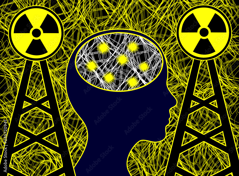 Electrosmog affects the brain. Electromagnetic radiation harms the ...