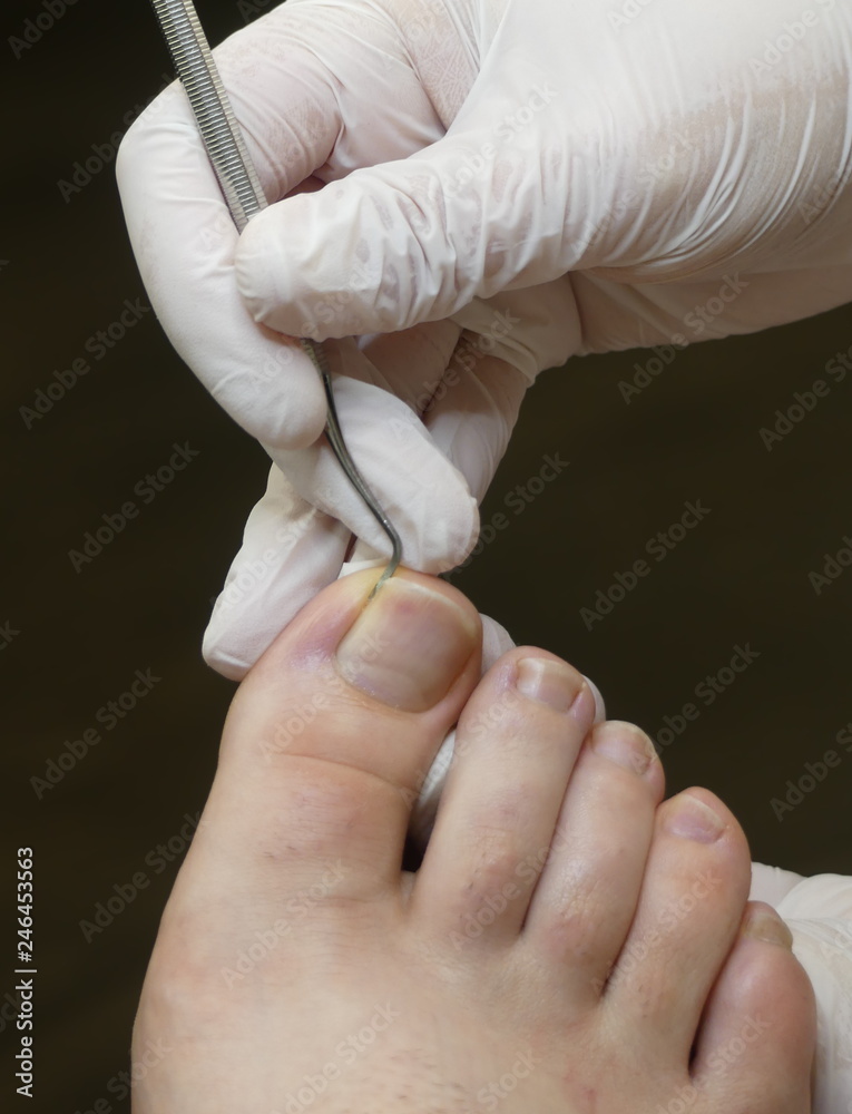 Podiatrist, Podiatry, Podologie, Podologe, Chiropodist, Fusspflege ...
