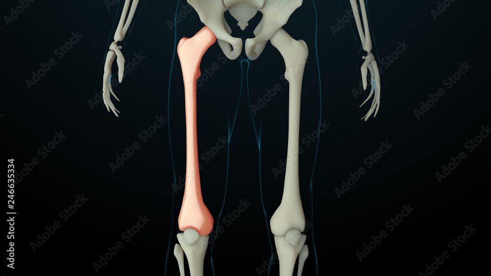 3d rendered illustration of skeleton structure with injured bones. Bone ...
