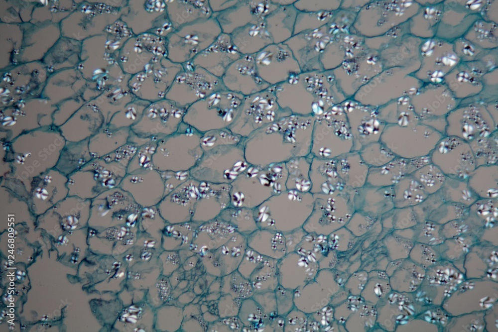 Potato Cells Under A Microscope