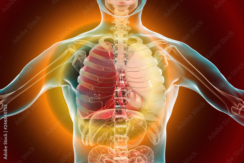 Pneumonia medical concept, 3D illustration showing lobar pneumonia of ...