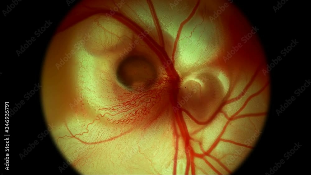 heartbeat and movement of blood through the vessels of a chicken or ...