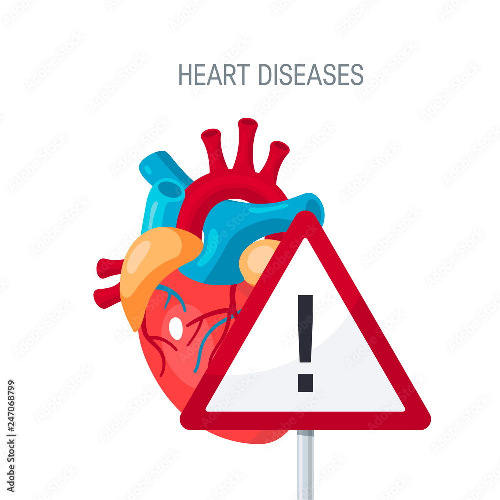 Heart diseases vector concept in flat style Stock Vector | Adobe Stock