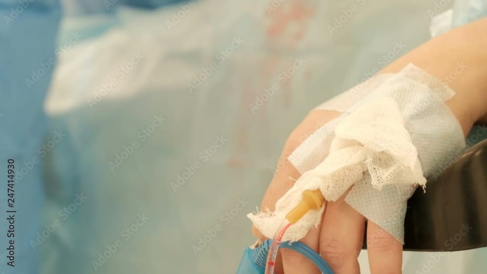 Fat woman on the operating table. The movement of the video camera from ...