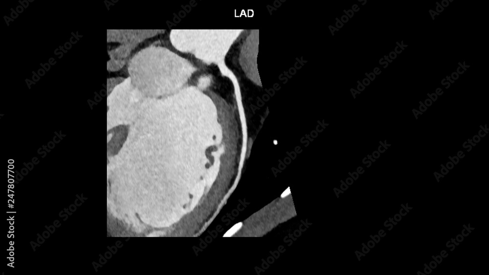 What Are The Branches Of The Lad