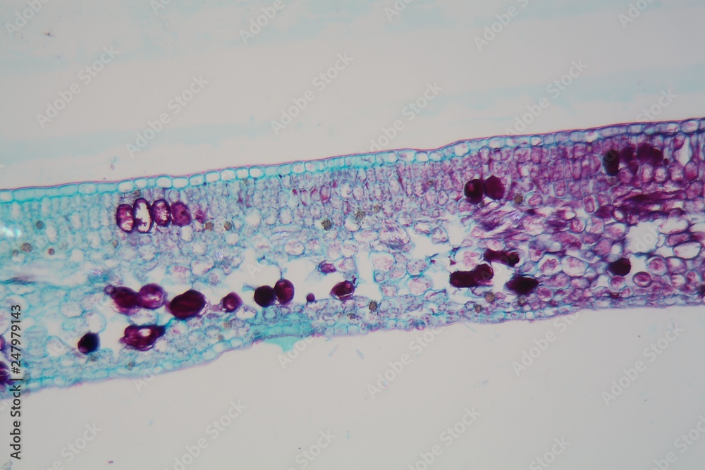 Cells of a plant leaf with damaged epidermis and chloroplasts under a ...