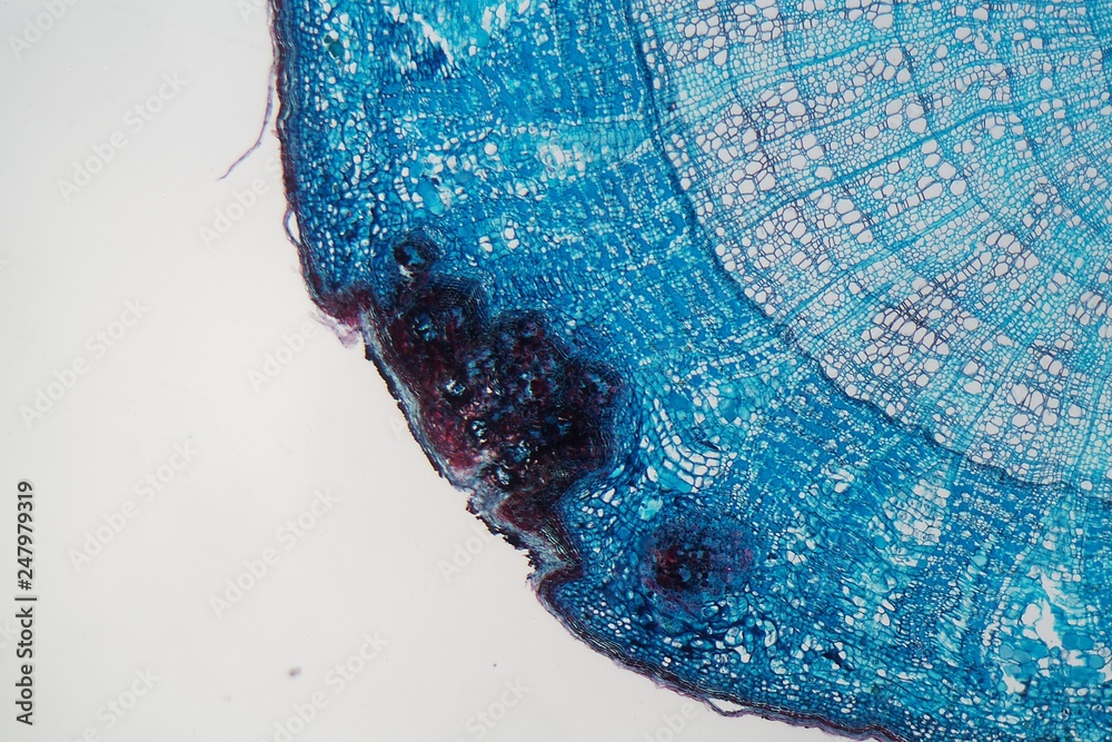 Cells of a plant stem with a disease under a microscope Stock Photo ...