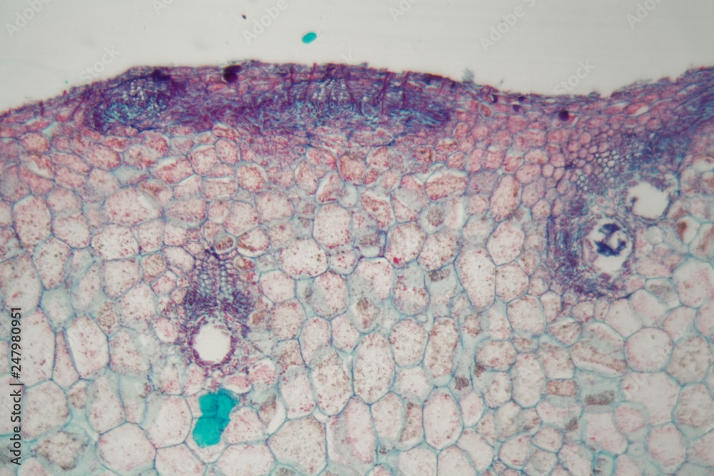 Plant cells with damages caused by a parasitic animal under the ...