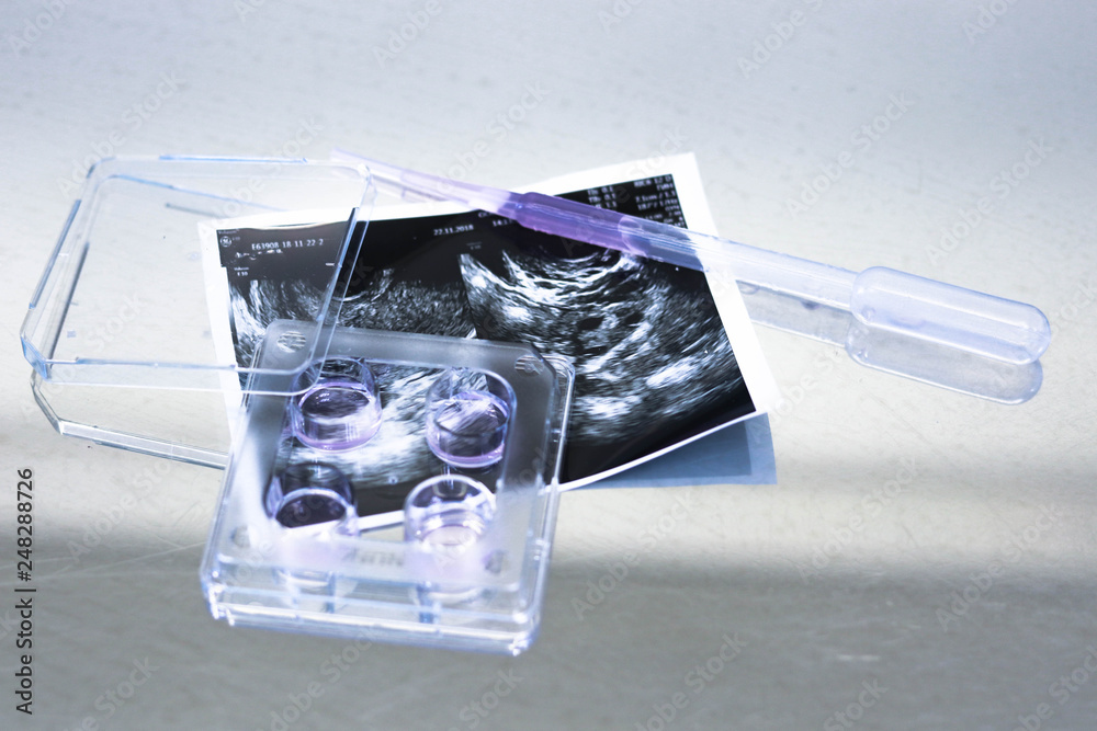 plate for cultivation of embryos in the IVF program amid an ultrasound ...