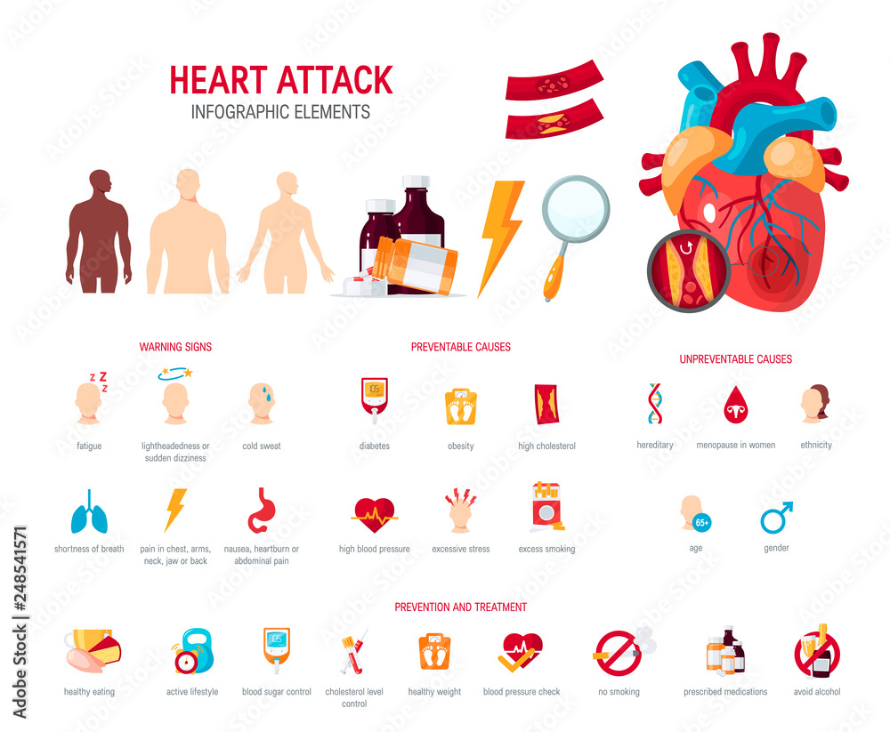 Heart attack concept in flat style, vector Stock Vector | Adobe Stock