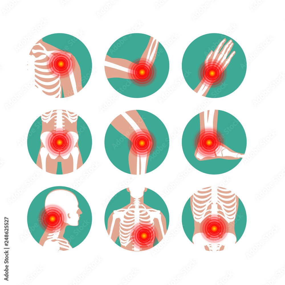 Rheumatism or rheumatic disorder medical set. Arthritis joint pain ...