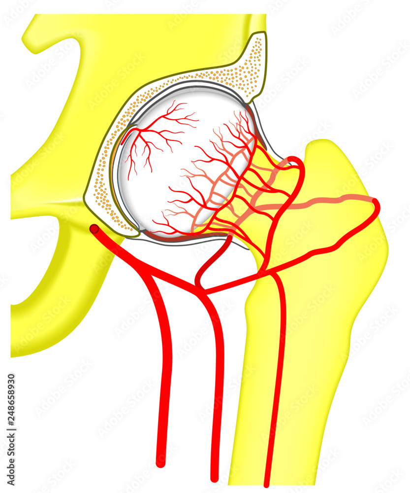 Vector illustration anatomy of a healthy human hip joint and a vascular ...