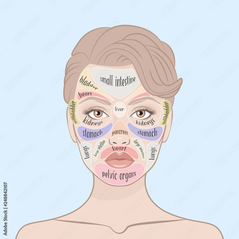 Acne Face Map. Vector illustration of beauty woman face. Viscera ...