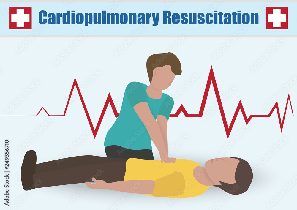 Infographic of Chest Compressions in Cardiopulmonary Resuscitation (CPR) Emergency Rescue ...