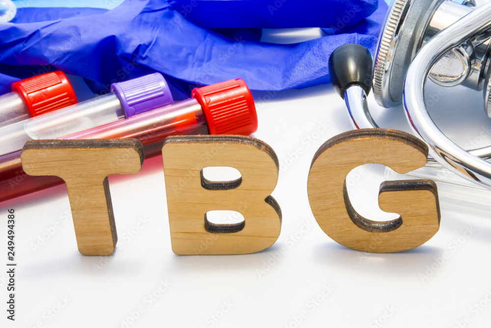TBG abbreviature mean thyroxine binding globulin with lab tubes with ...