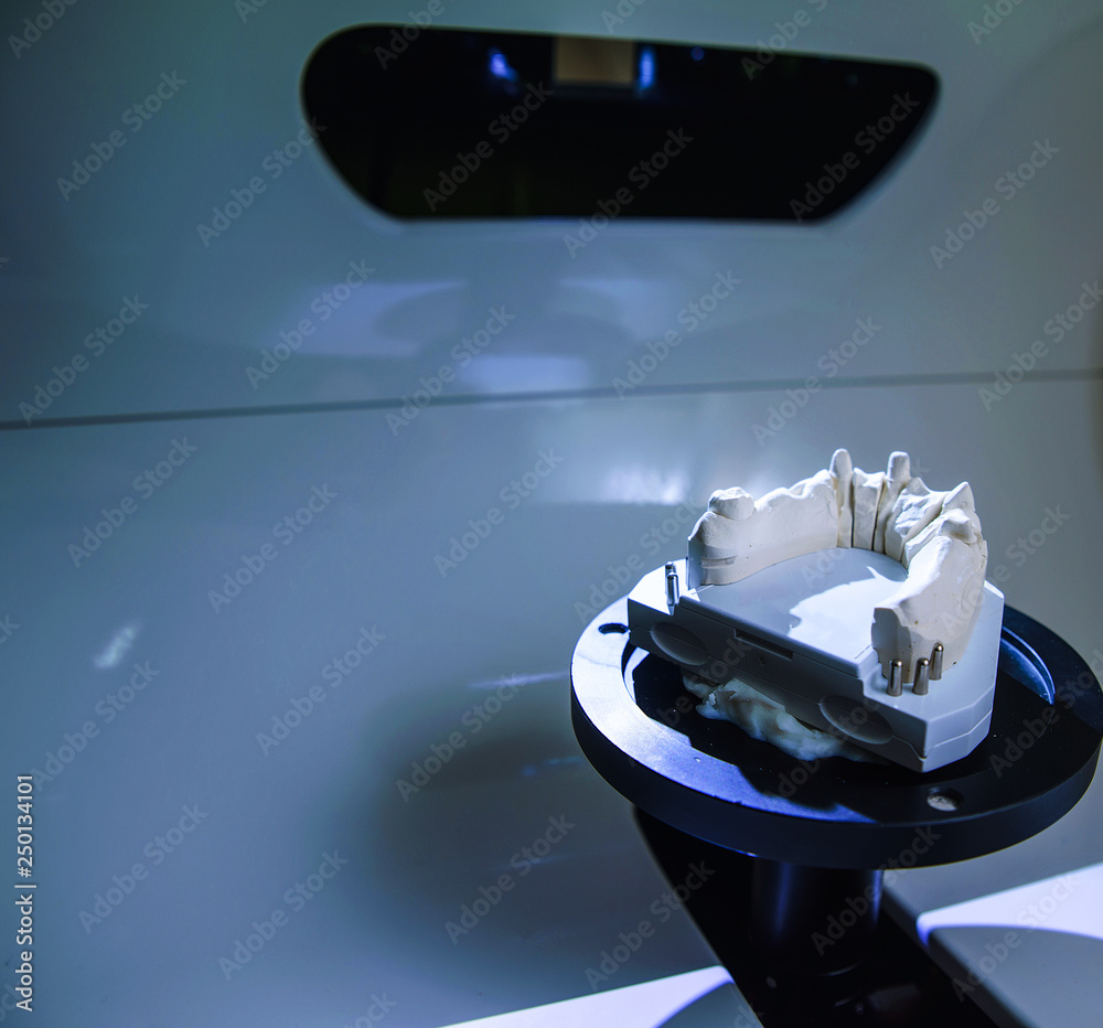 Specialized dental 3D scanner reads information from the plaster model ...