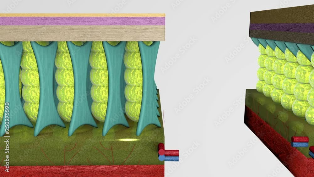 3D animation structure of normal skin tissue layers.Comparison between ...
