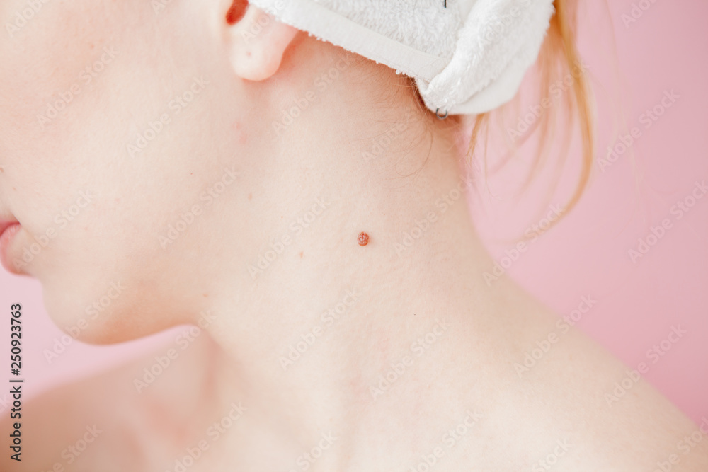 Close up view on the back of a female neck on a woman with her hair ...