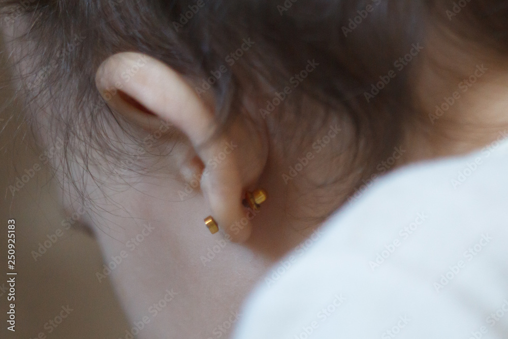 ear piercing for small children, one year old child Stock Photo | Adobe ...
