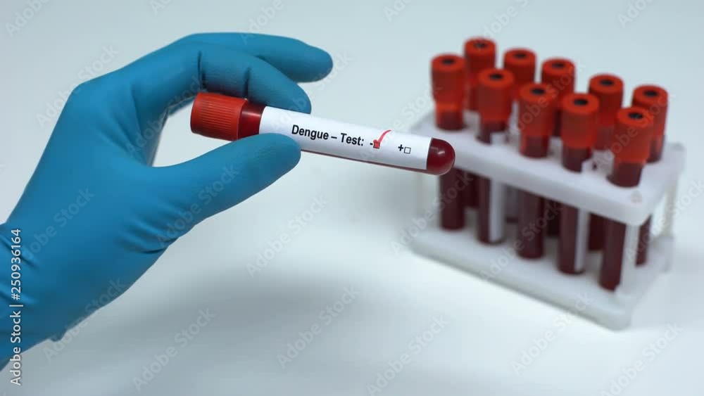 Vidéo Stock Negative dengue test, doctor showing blood sample, lab ...