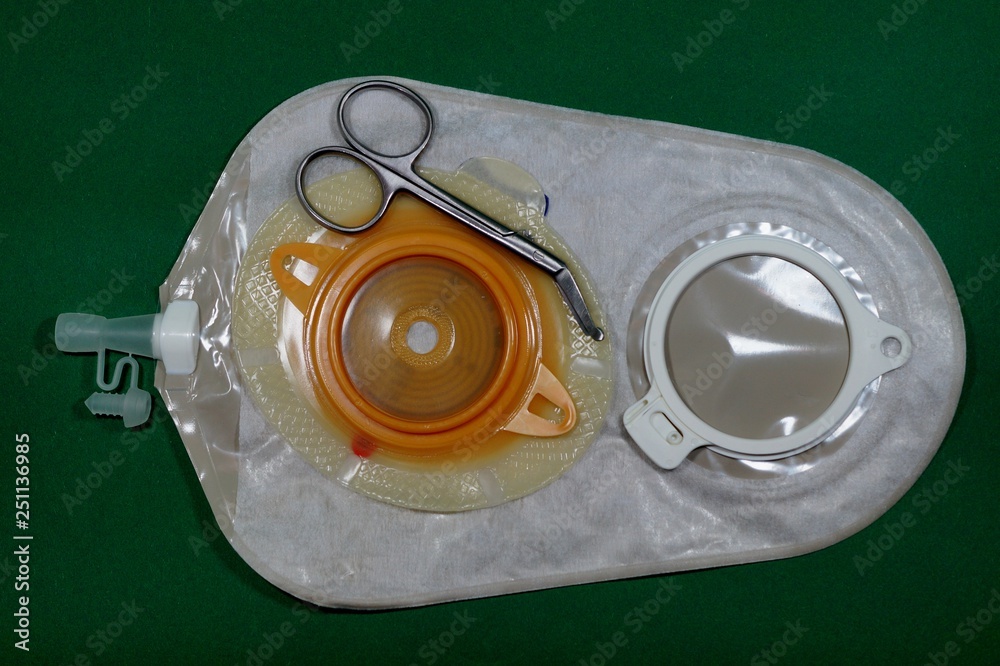 Foto Stock Urostomy - Ostomy medical care equipmen: Two-piece urostomy ...