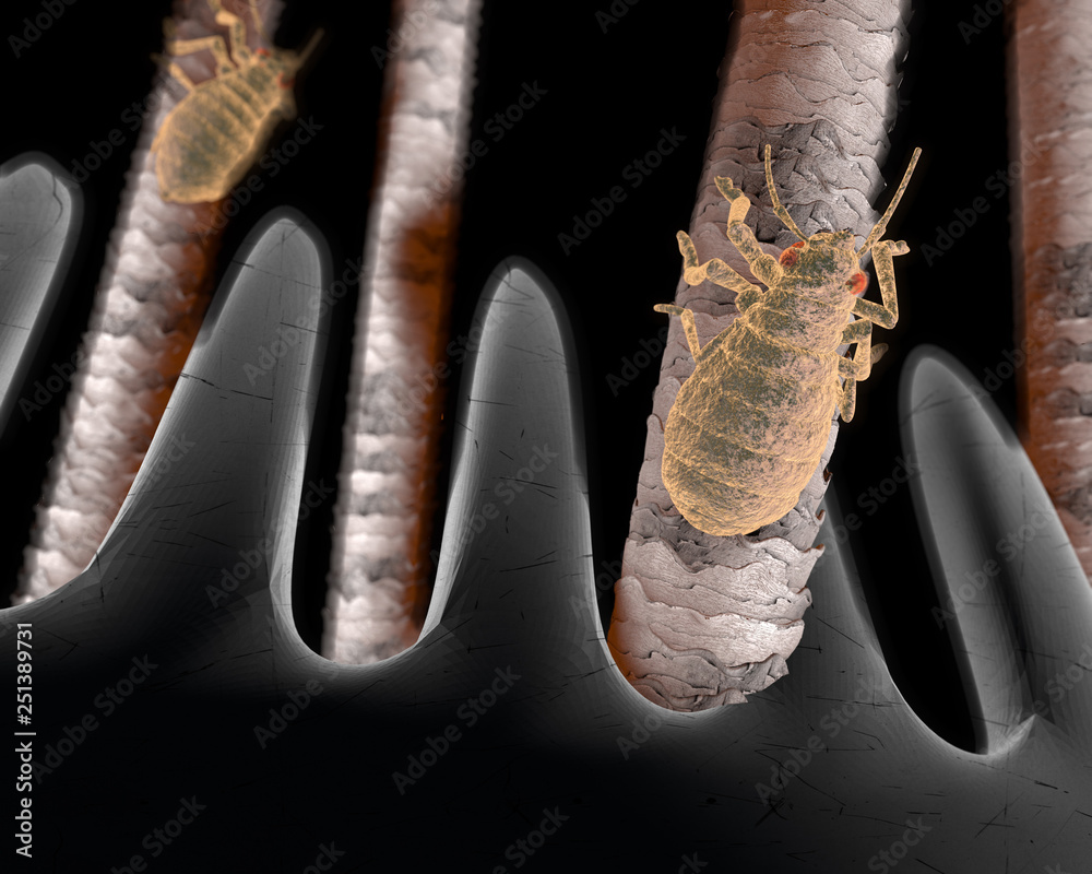 Lice Under Microscope