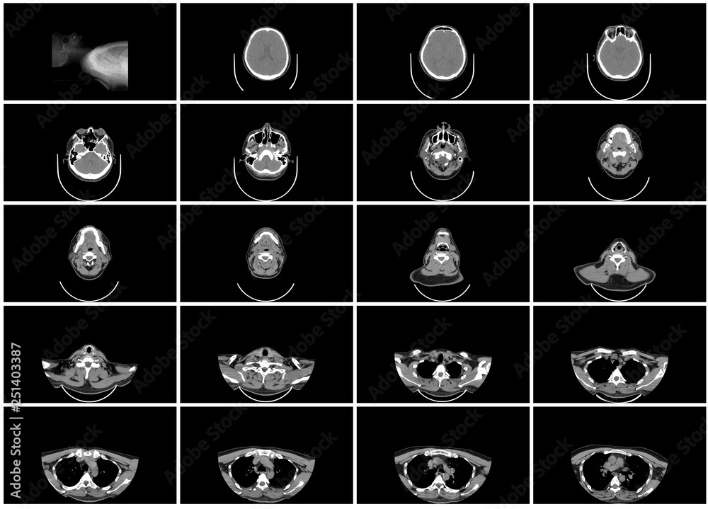 ct scan step set of upper neck axial top view Stock Photo | Adobe Stock