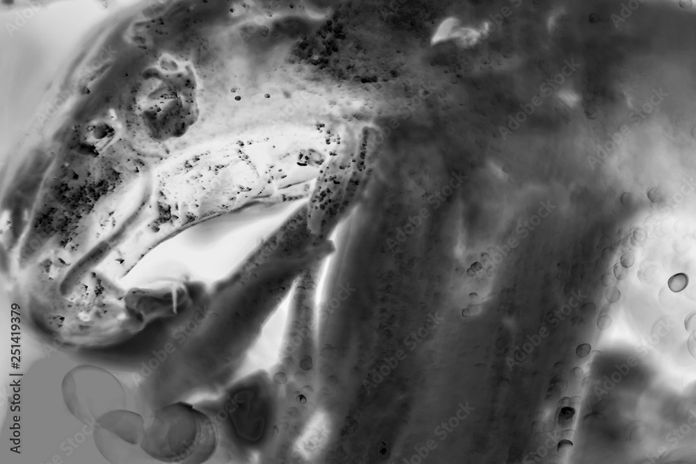 cancer cells under a microscope. Tissues affected by cancer cells under ...