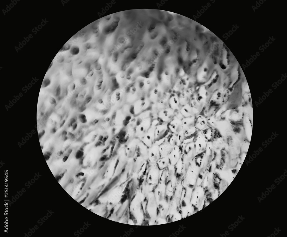 bacteria or cells under a microscope. Multiplication of bacteria or ...