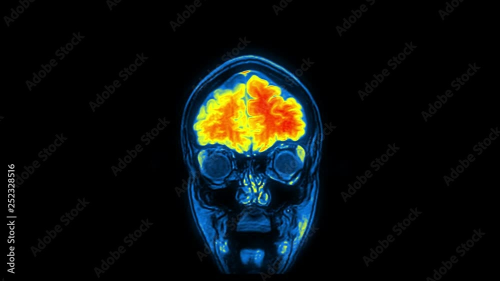 Computed medical tomography MRI upscaled scan of healthy young female ...