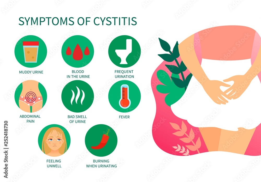 Vector medical poster symptoms of cystitis. Diseases of the ...