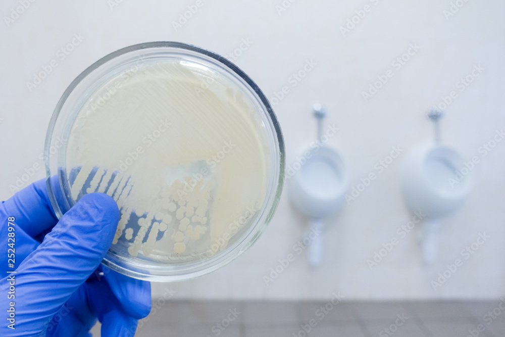 Bacteria in the toilet. Analysis of cleanliness after cleaning ...