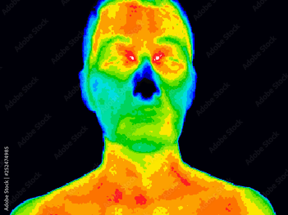 Thermographic image of a human face showing different temperatures in a ...