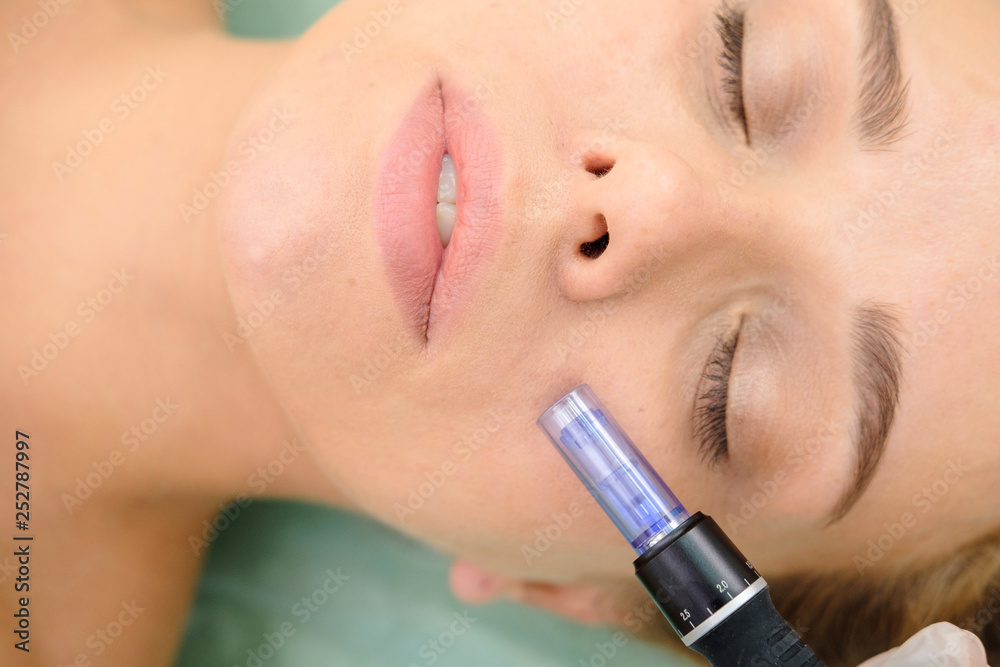 Cosmetologist making mesotherapy injection. Microneedle mesotherapy ...