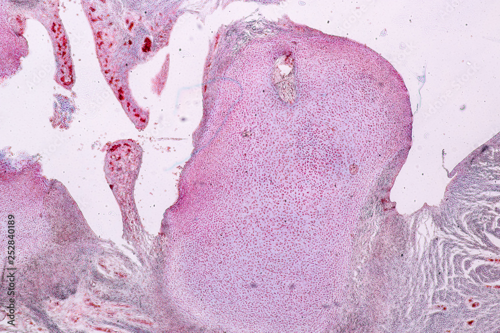 Study Histology of human, tissue bone under the microscopic in ...