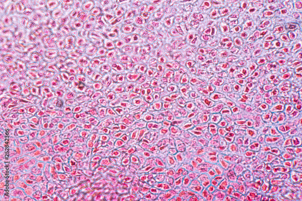 Study Histology of human, tissue bone under the microscopic in ...