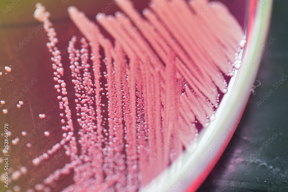 Colony characteristic of Actinomyces, Bacteria, yeast and Mold on ...