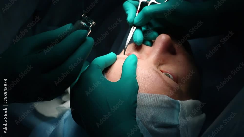The surgeon is performing an operation on the eyes, close-up. The ...