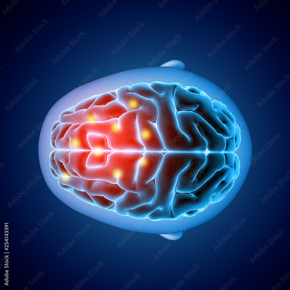 3D medical image showing top view of a brain with parts highlighted ...