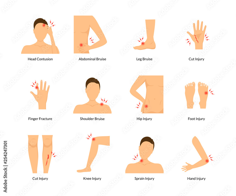 Cartoon Color Pain Human Body Set. Vector Stock Vector | Adobe Stock