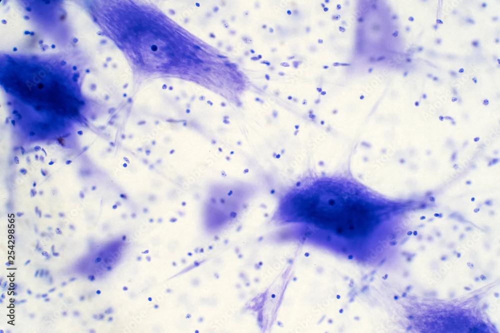 Neurons cells from the brain under the microscope view. Stock Photo ...