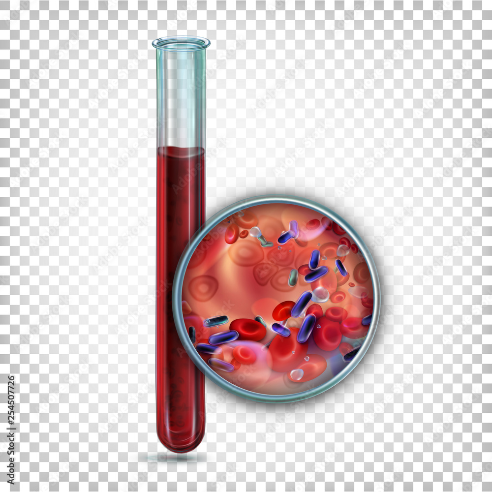 Laboratory glass test tube with blood. Enlarged blood under the ...