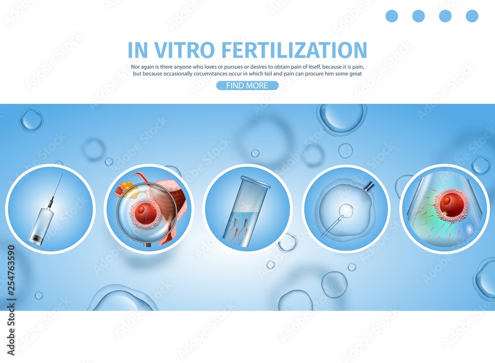 IVF Process Procedures Schematic Explanations. Stock Vector | Adobe Stock