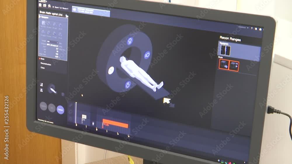 Computer monitor of MRI CT scanner - recording the patient's head Stock ...