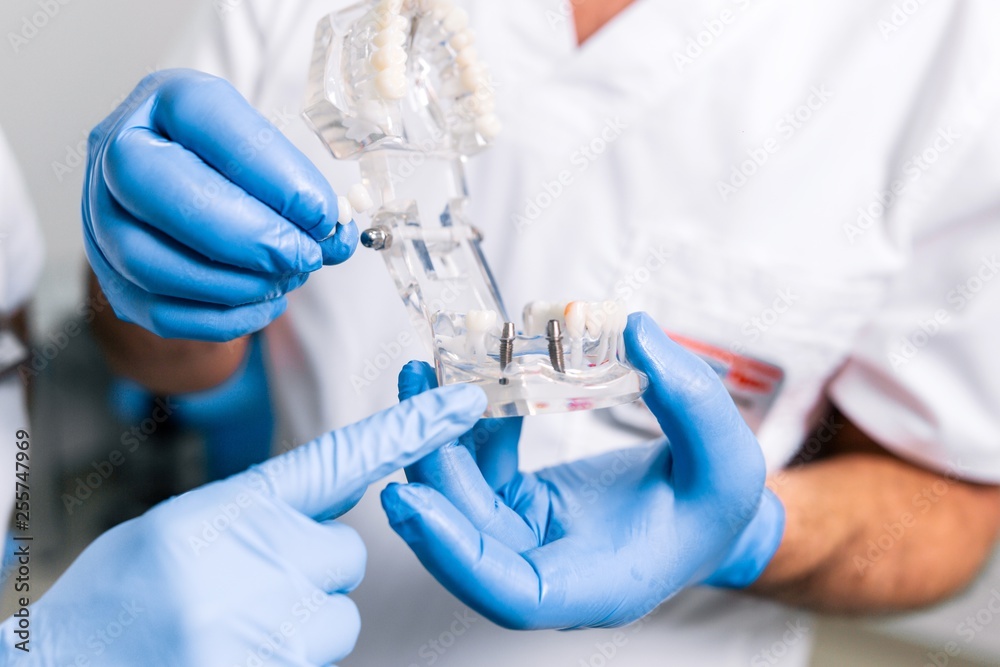 Dentist shows the Intern prosthetics on the training layout close-up ...