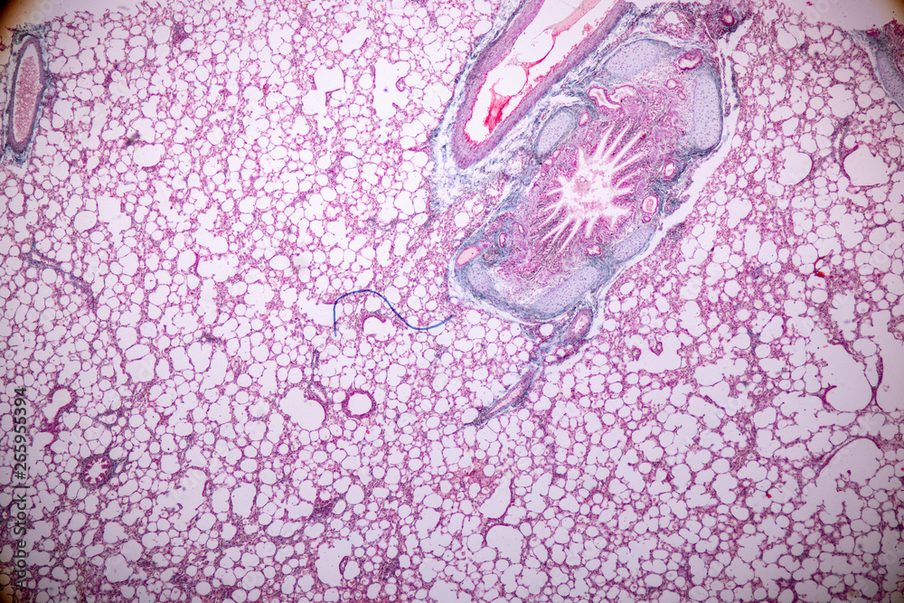 Poster Concept of Education anatomy and Human lung tissue under ...