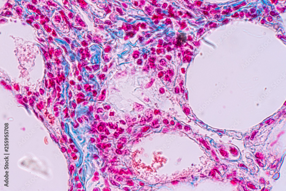 Foto de Concept of Education anatomy and Human lung tissue under ...